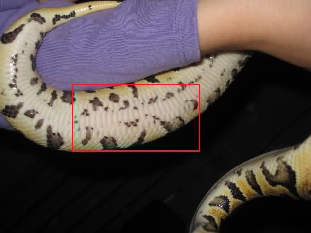 Light Pink On Belly Possible Burn