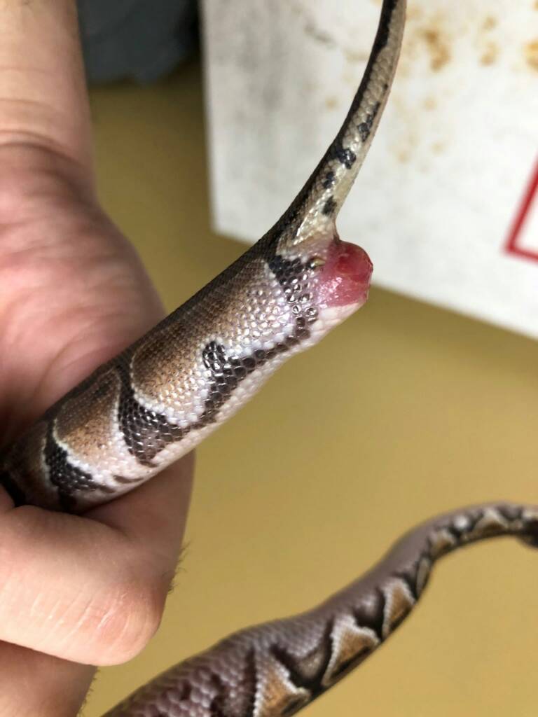 Prolapse